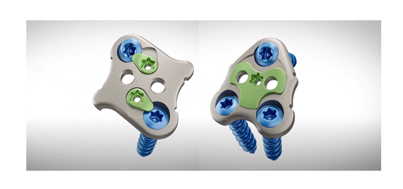 FDA 510(k) Clearance for Prase-C™ Anterior Cervical Plate System